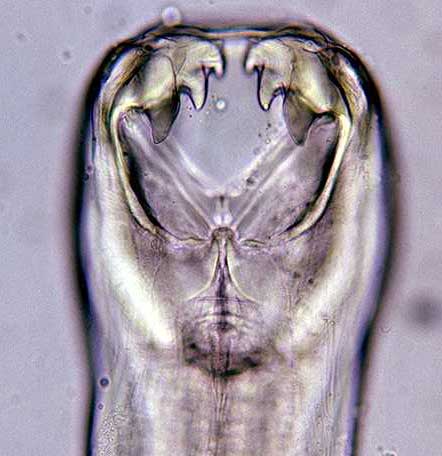 Enemas For Parasite And Toxicity Removal - Earther Academy